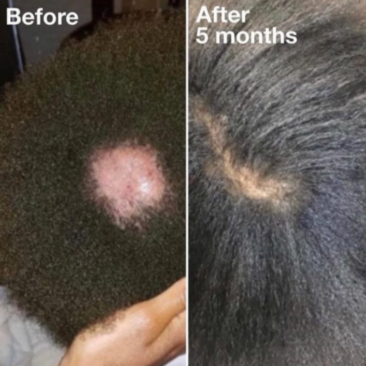 Best Natural Hair Growth Products 2026 | OrganiGrow Complete Guide ...